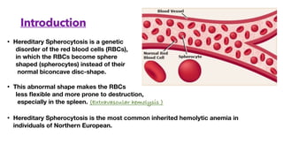 Hereditary Spherocytosis .pdf | Anemia | | PDF