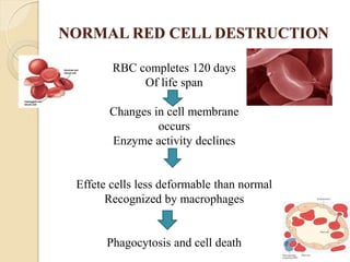 Hereditary spherocytosis asif new | PDF