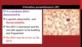 Hereditary Spherocytosis -HS | PDF