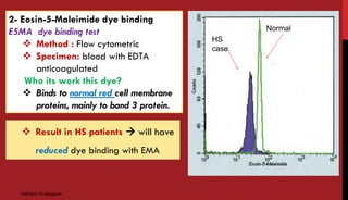 Hereditary Spherocytosis -HS | PDF