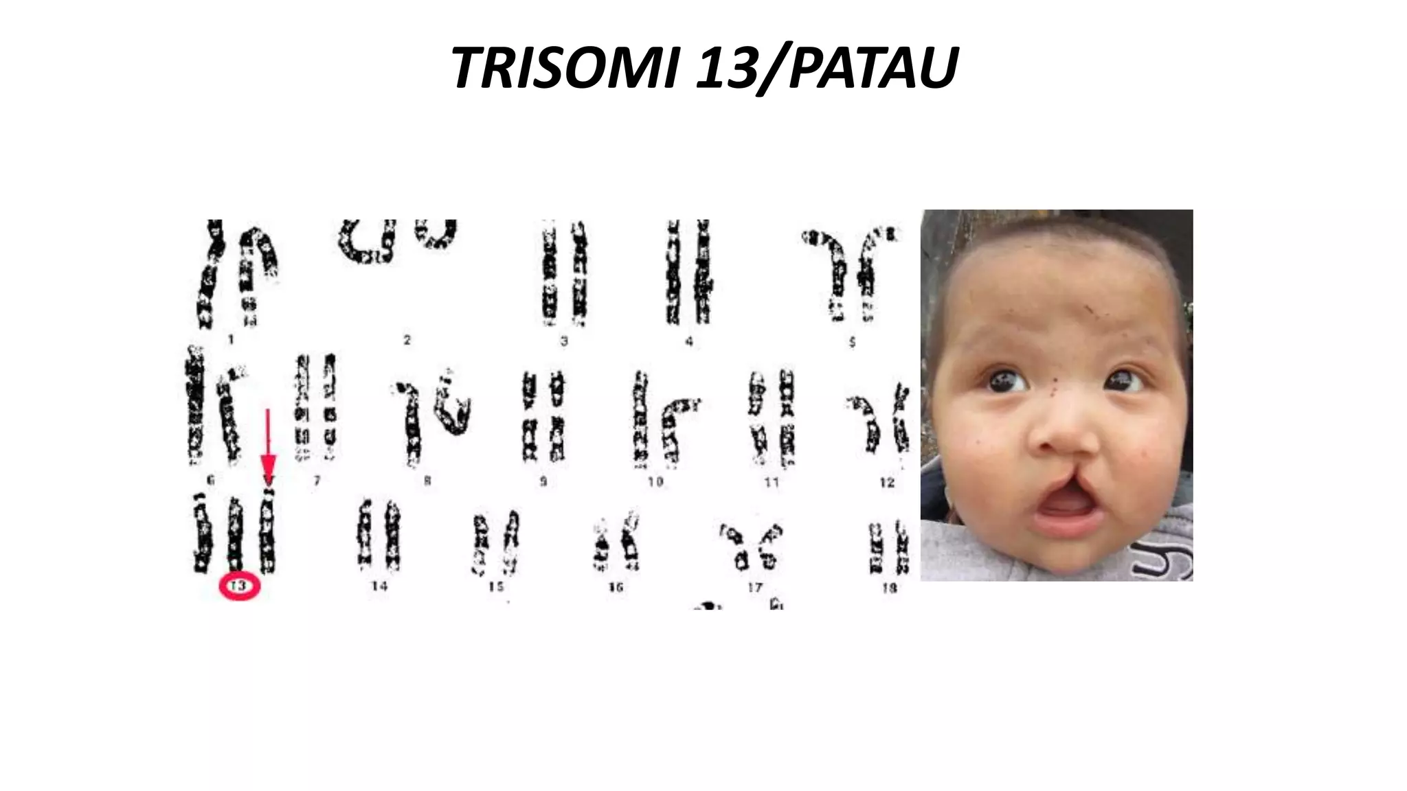 hereditas pada manusia.pptx