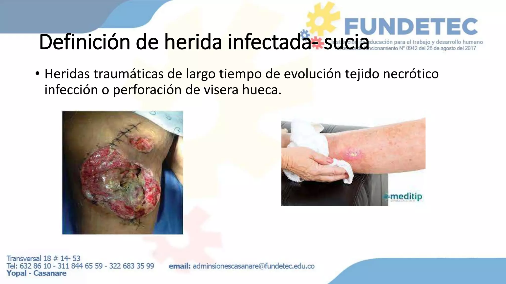 Herida Infectada-Sucia.pptx