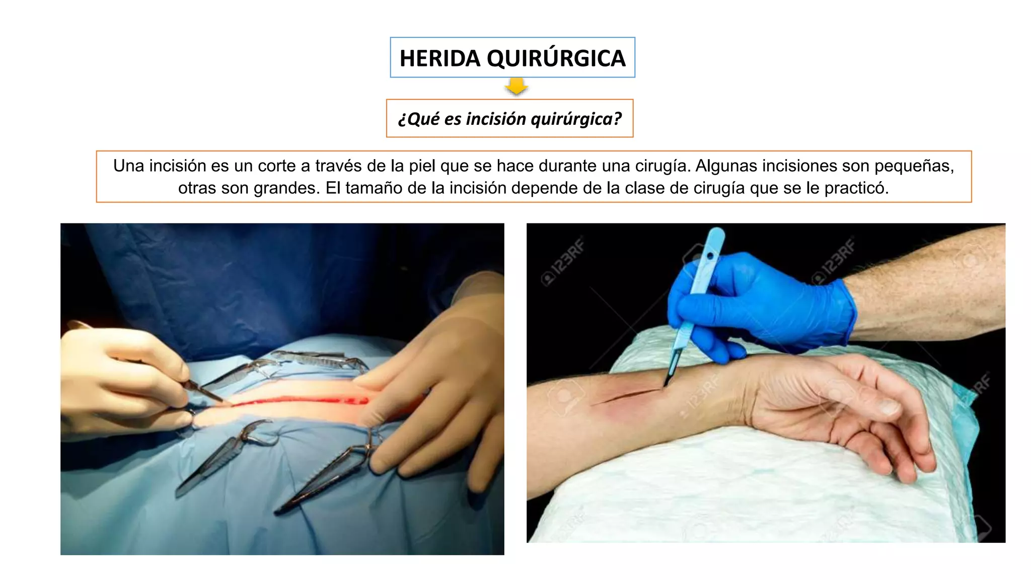 Herida quirurgica | PPT