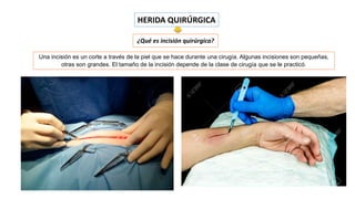 Herida quirurgica | PPTX