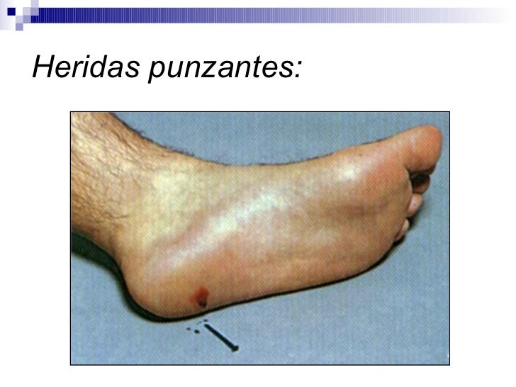 Heridas