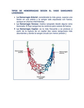 Heridas | DOCX