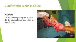 Heridas, Fisiopatología, Clasificación, Complicaciones | PPTX