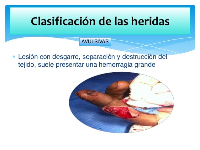 Heridas!!!!