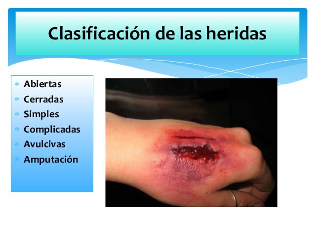 Heridas!!!!