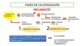 Heridas - Cicatrización | PPTX