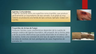 Heridas, generalidades | PPTX