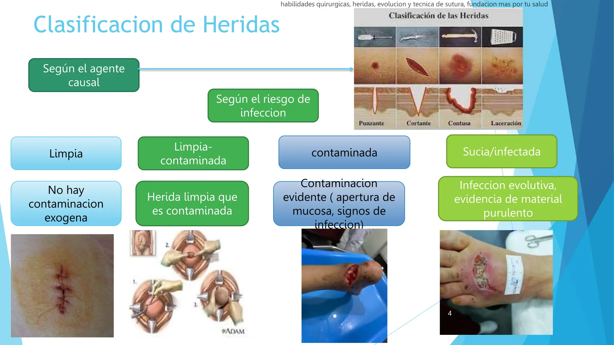 clasificación de las heridas/etapas de infección | PPTX
