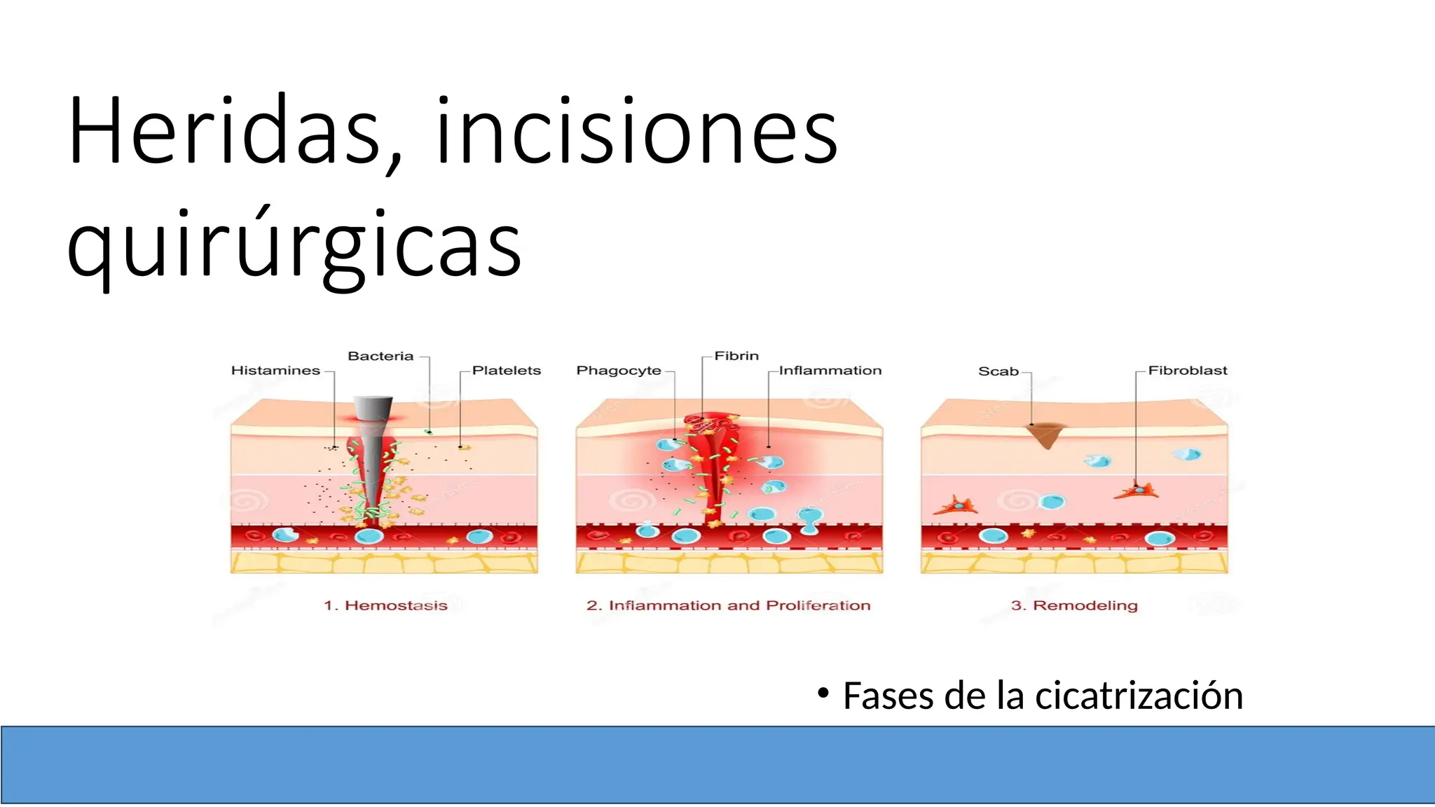 HERIDAS, incisiones quirúrgicas, fases de la cicatrización | PPTX