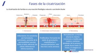 HERIDAS, incisiones quirúrgicas, fases de la cicatrización | PPTX