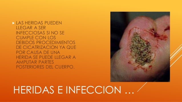 las Heridas y los primeros auxilios