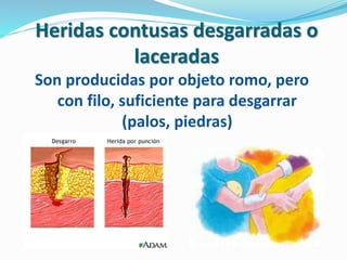Heridas, clasificación y primeros auxilios en cada caso | PPTX