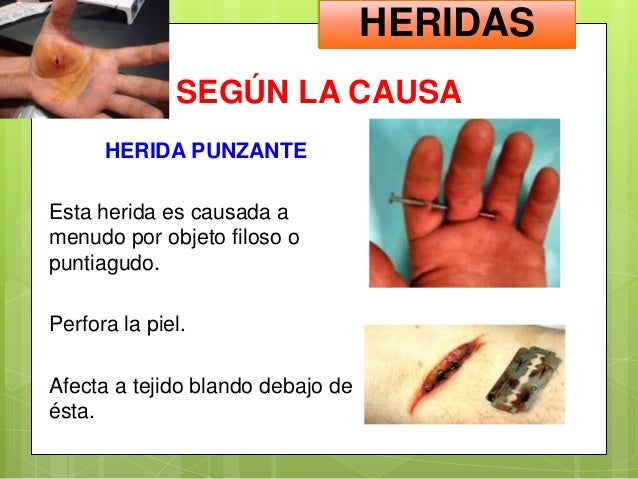 HERIDAS CLASIFICACIÓN DE HERIDAS Y SU MANEJO