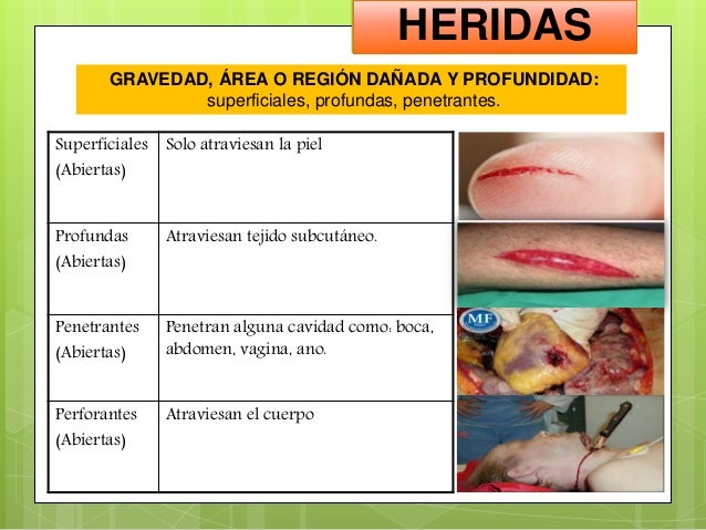 HERIDAS CLASIFICACIÓN DE HERIDAS Y SU MANEJO
