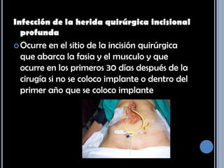 Heridas3 | PPTX