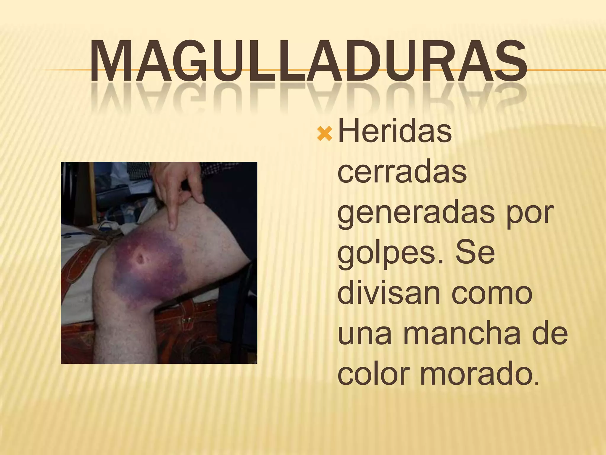 Heridas diapositiva | PPTX