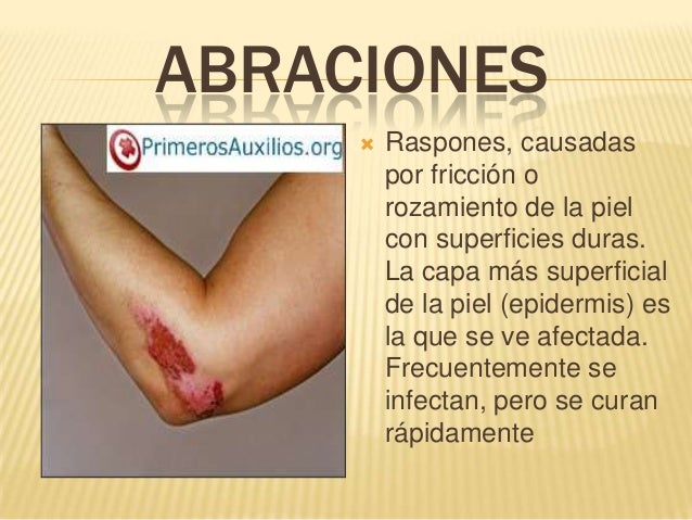 Heridas diapositiva