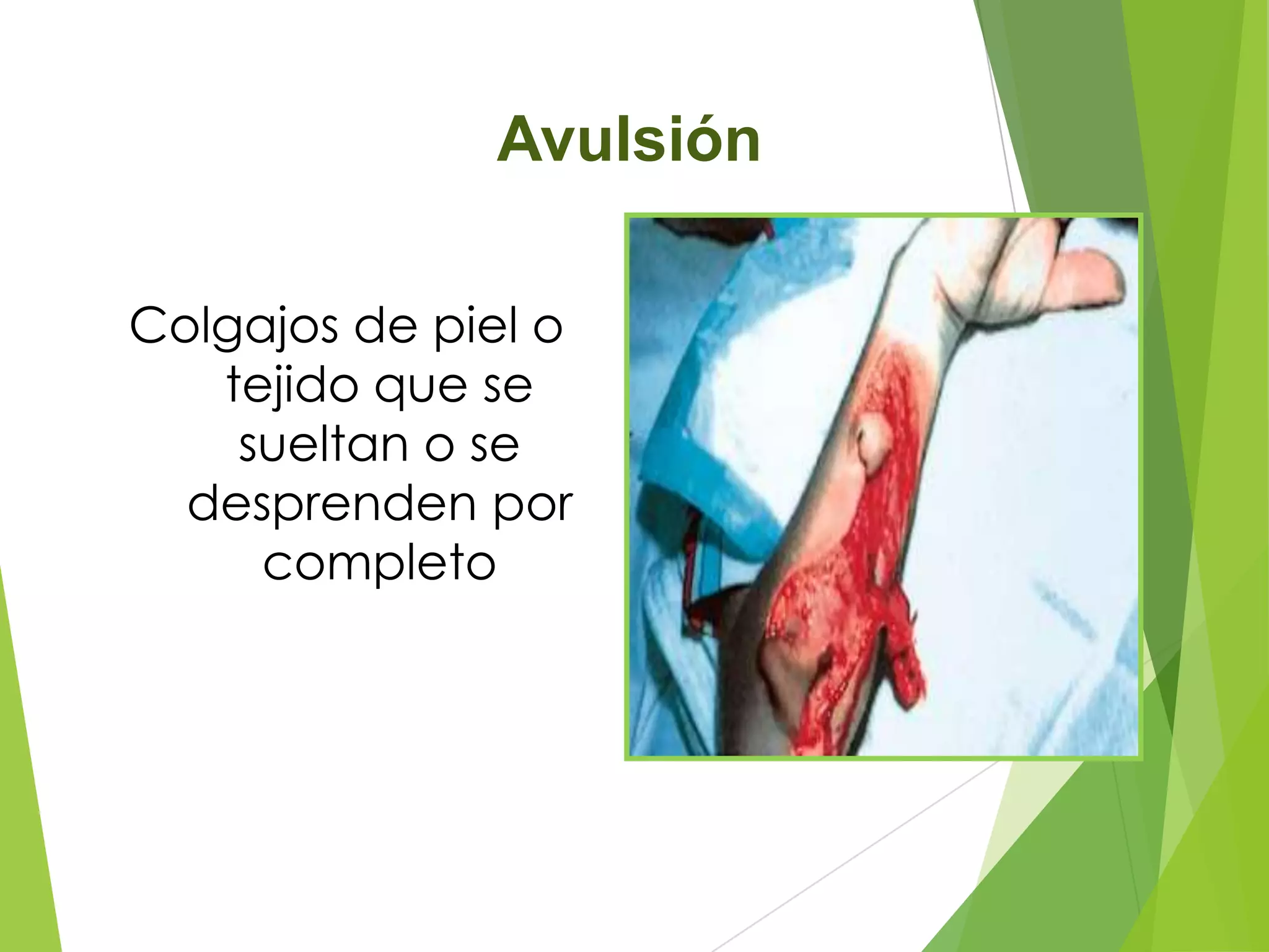 Heridas, lesiones y hemorragias | PPTX