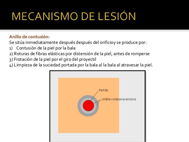 Heridas por arma de fuego traumatologia