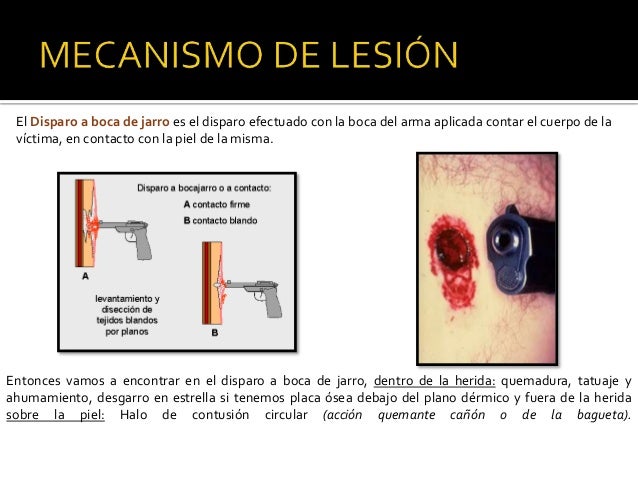 Heridas por arma de fuego traumatologia