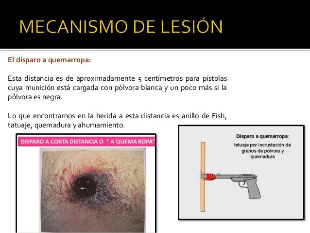 Heridas por arma de fuego traumatologia