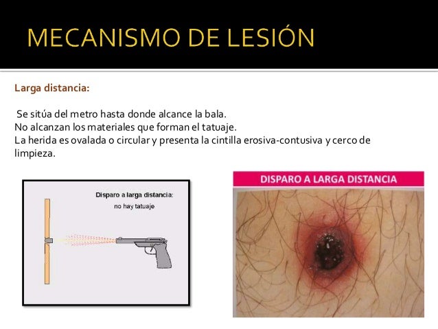 Heridas por arma de fuego traumatologia