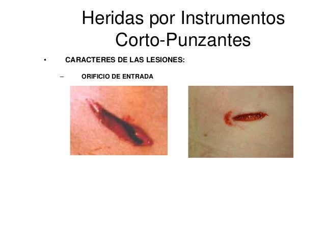Heridas por armas blancas b