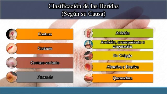 Heridas y clasificacion