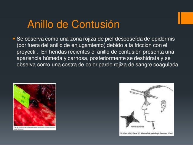 Medicina legal Juan Melendez 21505988