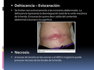 Heridas quirurgicas | PPTX