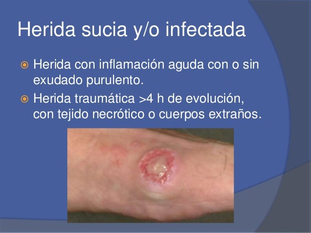 Heridas, sangrado y su tx