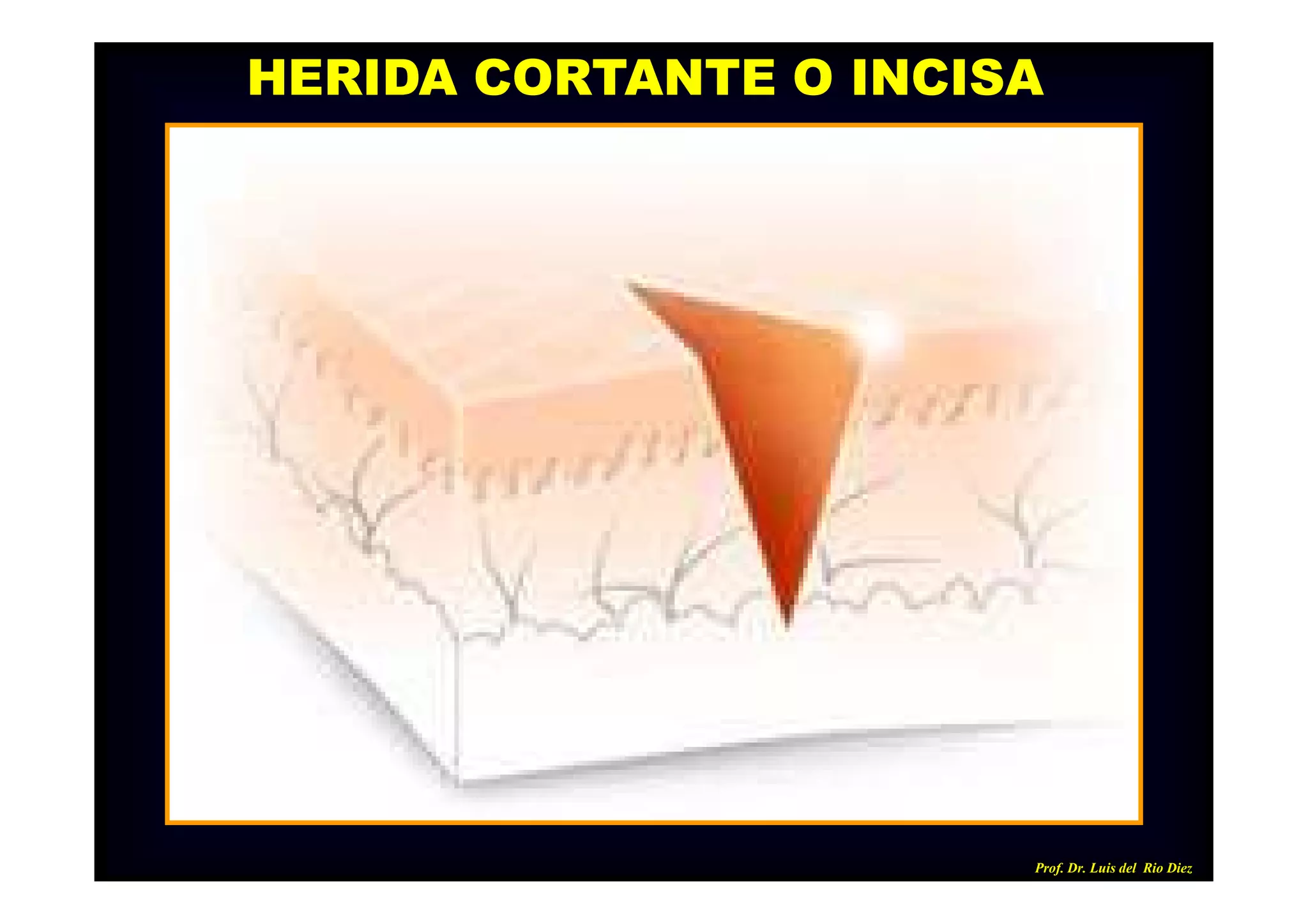 Heridas traumaticas. clasificacion y tipos. prof. dr. luis del rio diez ...
