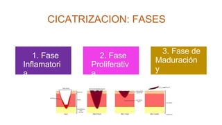 HERIDAS Y CICATRIZACION.pptx