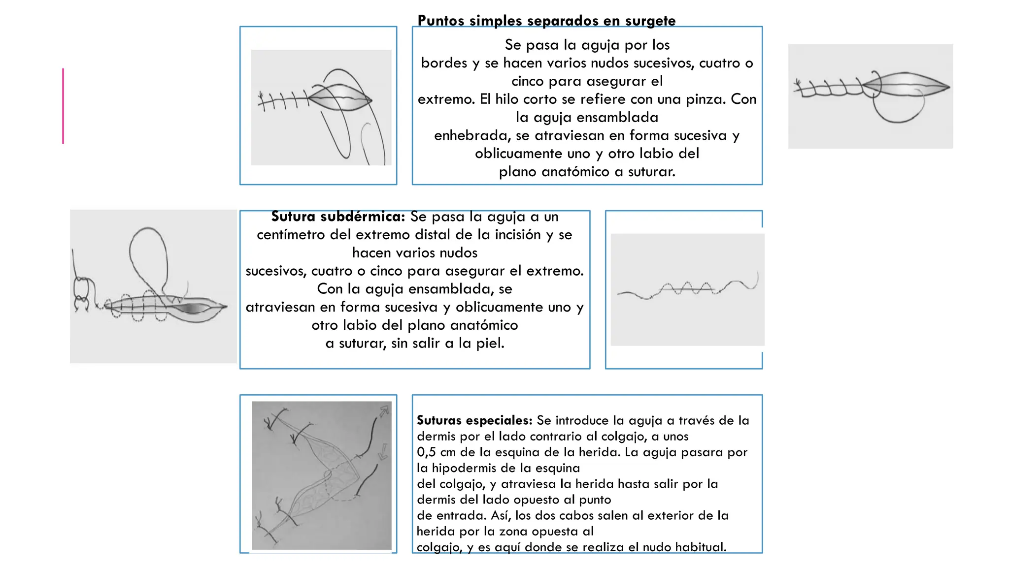 TIPOS DE HERIDAS Y EL PROCESO DE CICATRIZACION | PPTX