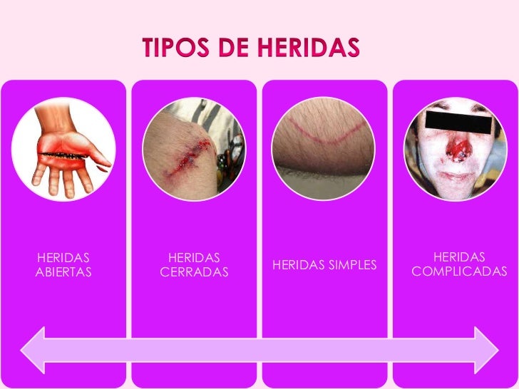 Heridas y curaciones protocolo 09