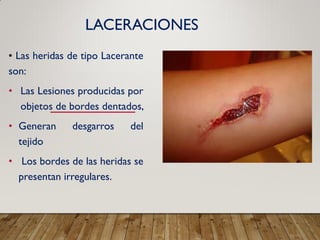 HERIDAS Y HEMORRAGIAS.pdf