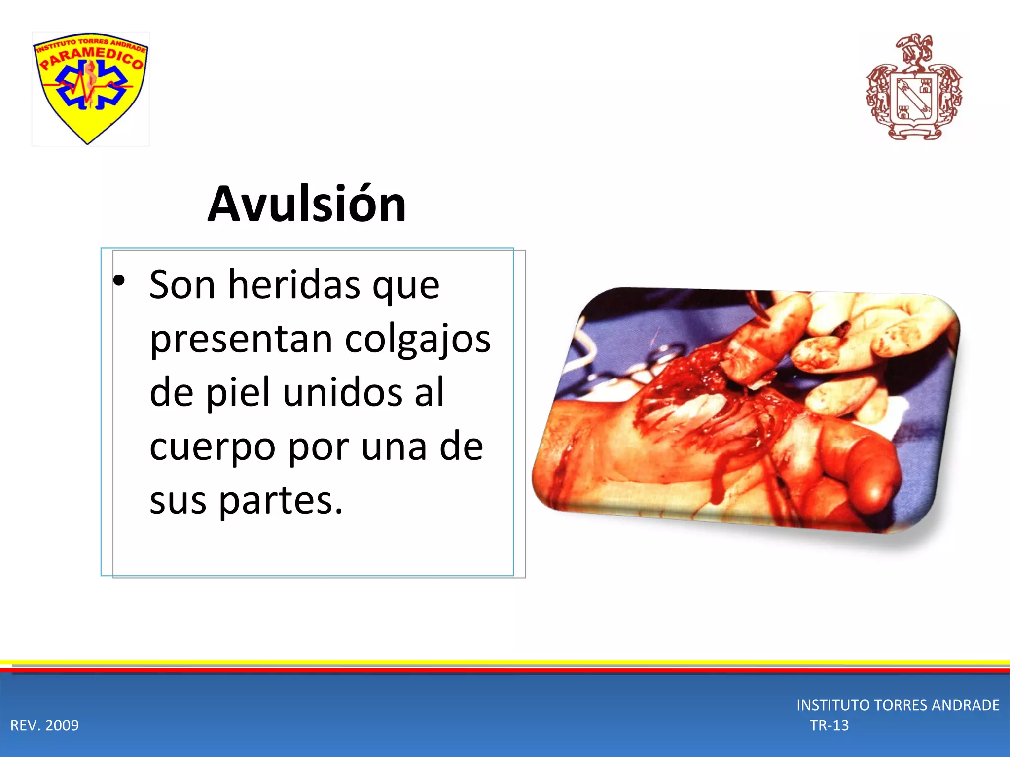 Heridas Y Hemorragias Ita 2009 | PPT | First Aid | Injuries