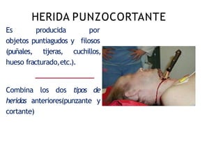 heridas y hemorragias sin editar.pptx