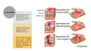 Heridas y Quemaduras presentacion para primeros auxilios | PDF