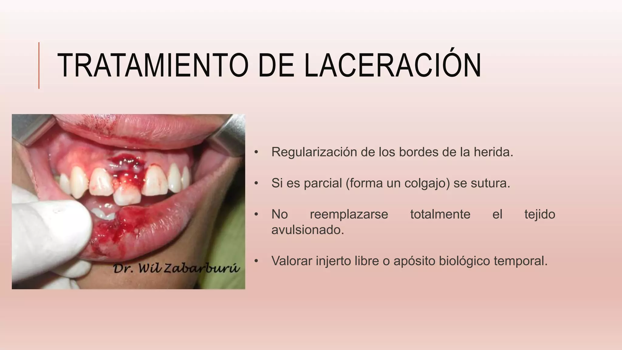 Heridas y traumatismos de los tejidos blandos maxilofaciales.pptx