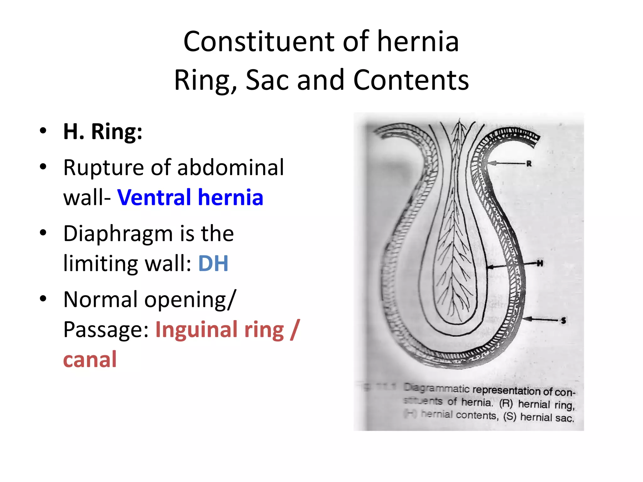 Hernia | PPTX | Digestive Disorders | Diseases and Conditions