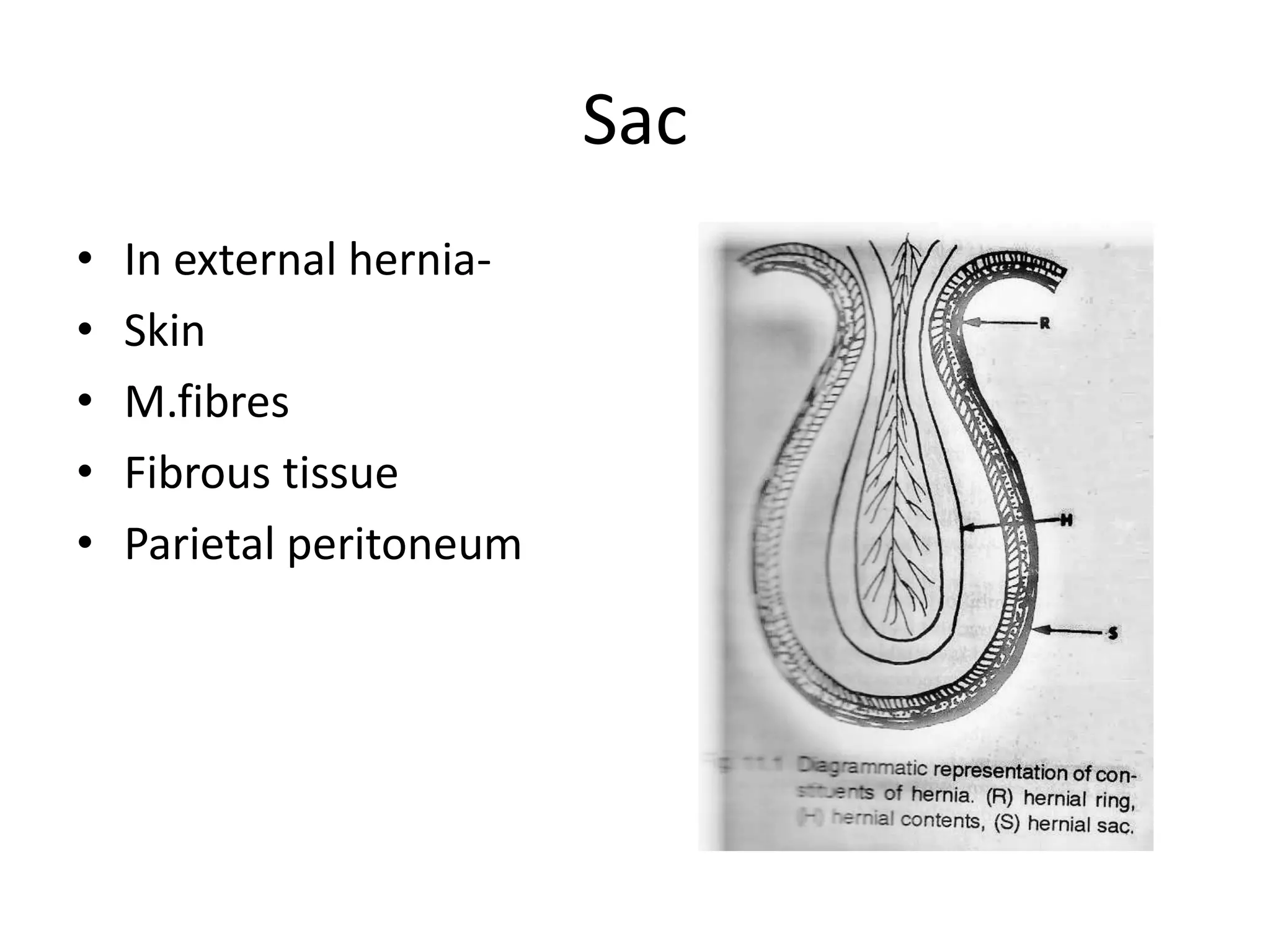 Hernia | PPTX | Digestive Disorders | Diseases and Conditions