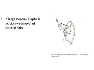 Hernia | PPTX | Digestive Disorders | Diseases and Conditions