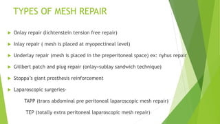 Hernia and its surgeries | PPTX
