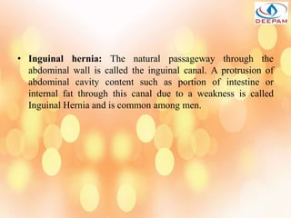 Hernia | PPTX