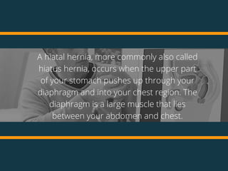 Medication for Hiatus Hernia | PDF